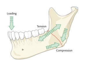 Intervento frattura della mandibola | Prof. Tartaro